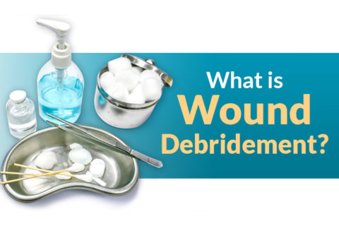 Wound Debridement: What It Is and How to Do It—Home Care Delivered